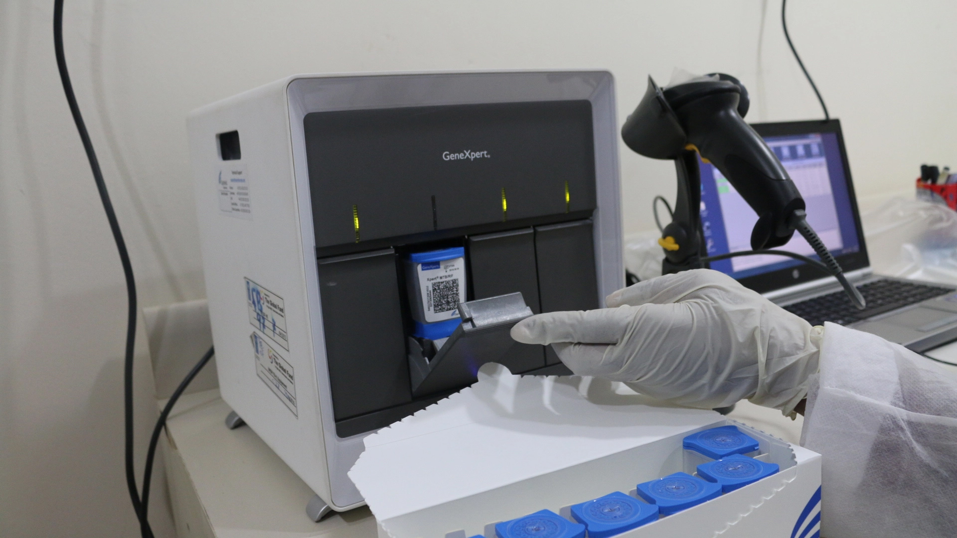 GeneXpert machine for Nyanga Hospital - herald